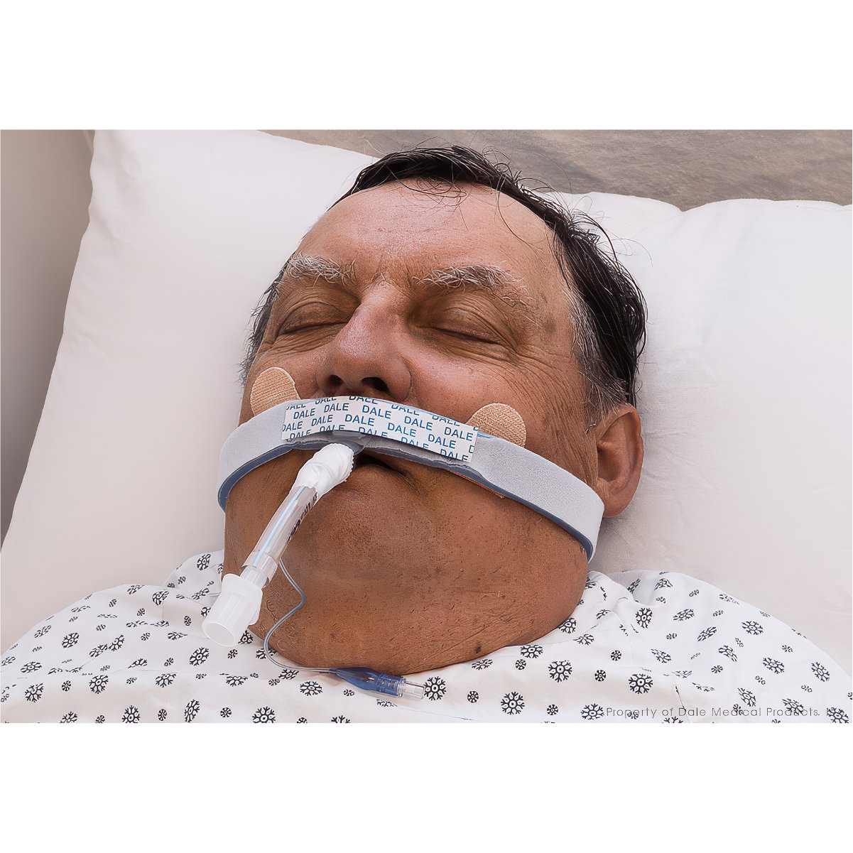 Dale Medical BreezeLock® Endotracheal Tube Holder